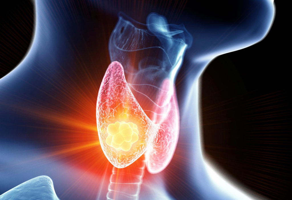 Doenças da paratireoide - Dr. João Spontão